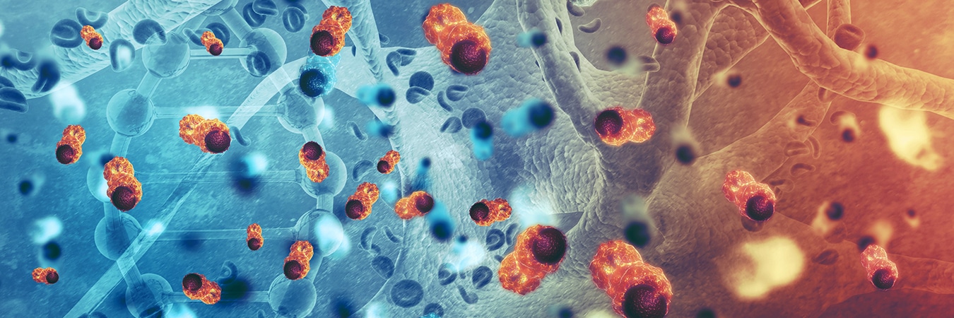 Cancer Therapeutics | NY | Montefiore Einstein Comprehensive Cancer Center