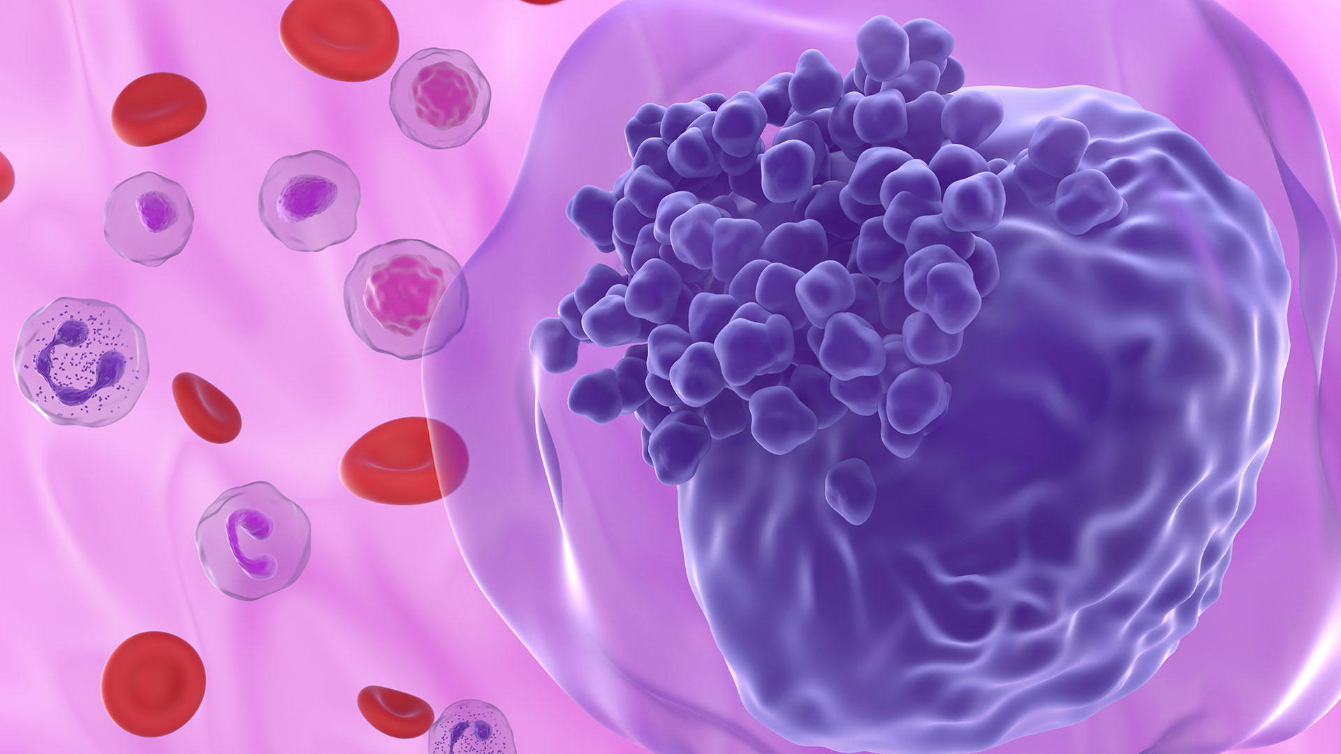 Strengthening CAR-T Therapy to Work Against Solid Tumors | Montefiore ...