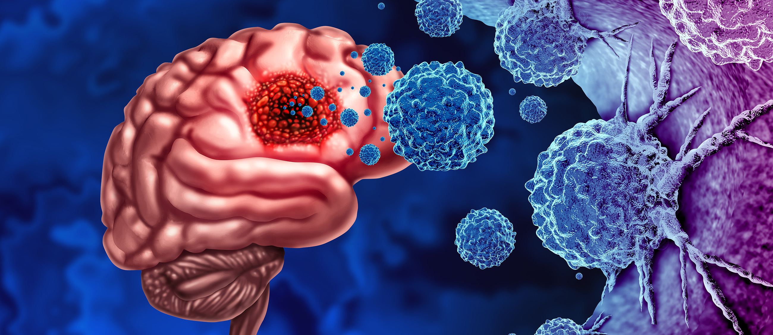 Montefiore Einstein Division of Neuro-Oncology Research
