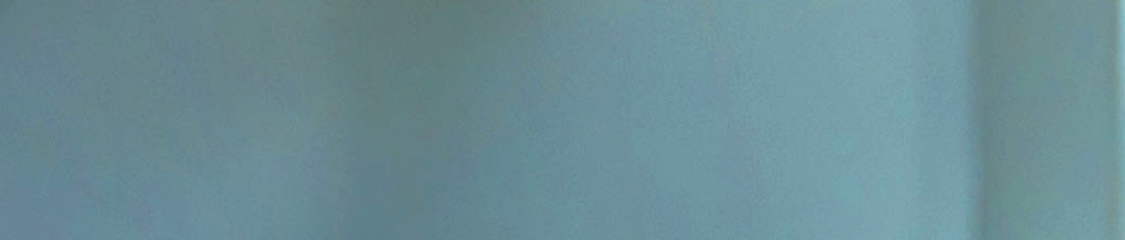 46,XY Disorder of Sex Development Due to 5-Alpha-Reductase 2 Deficiency ...