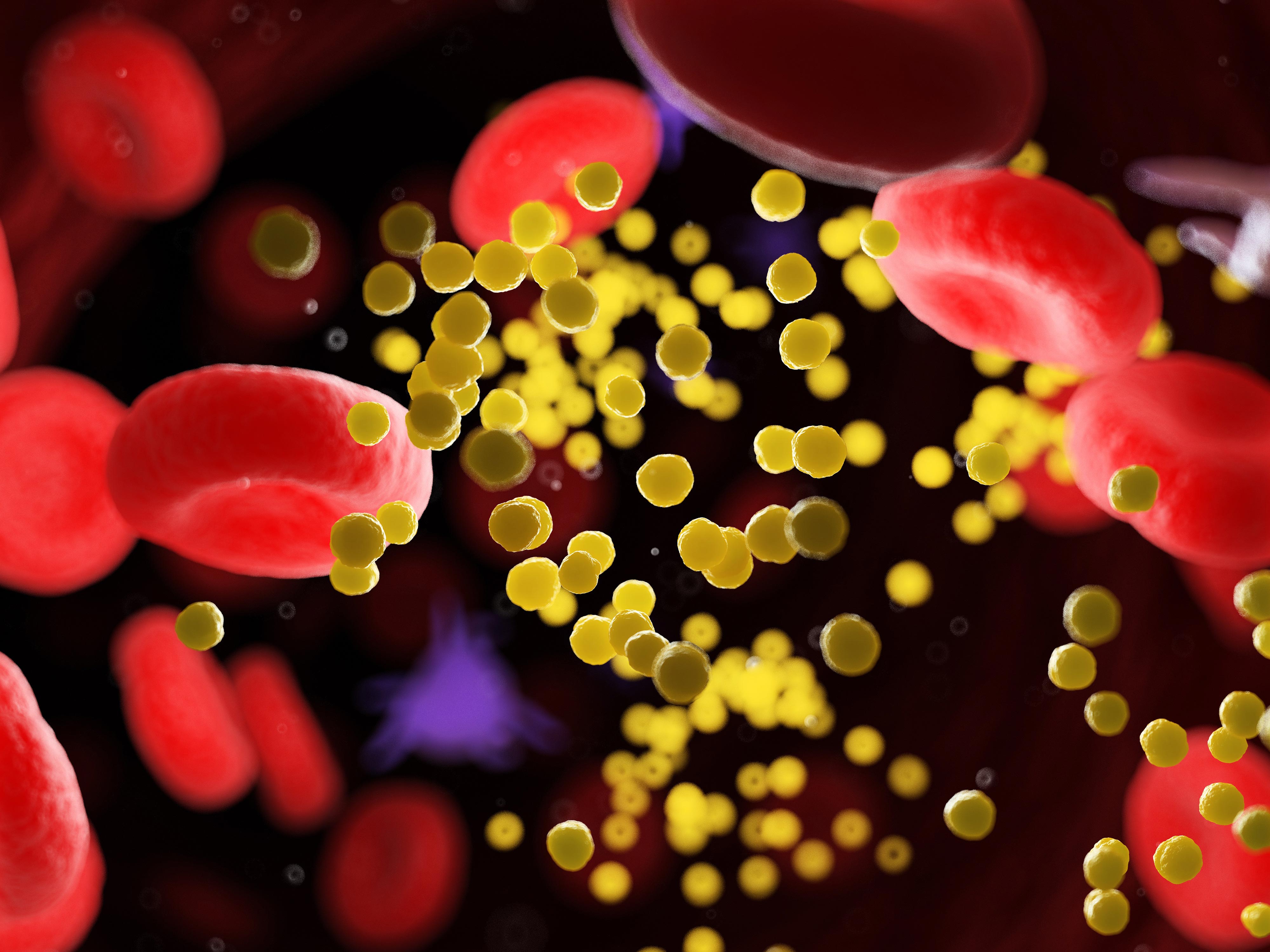 COVID-19 Sharply Boosts Risk for Blood-Fat Disorders | Montefiore Einstein