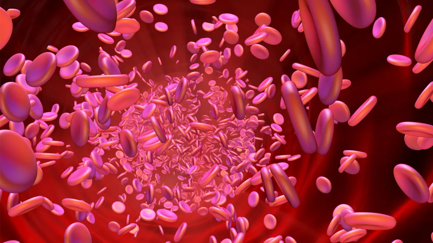 Blood Cancer Institute | NY | Montefiore Einstein Comprehensive Cancer ...